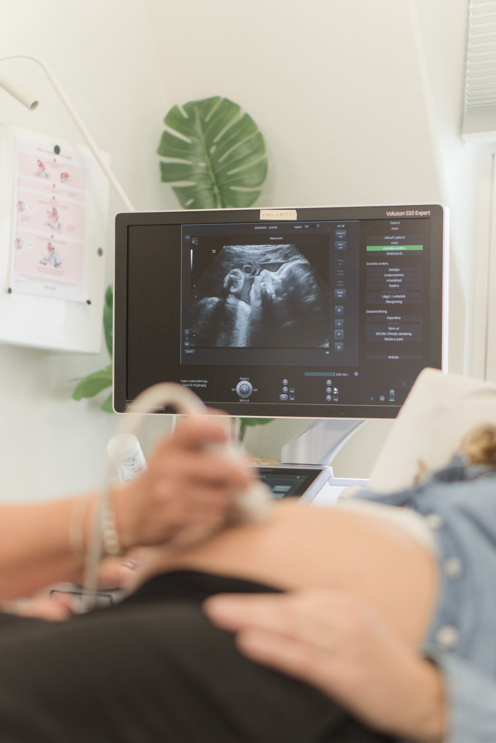 Analyser inom graviditet och fosterdiagnostik - Babyscreen